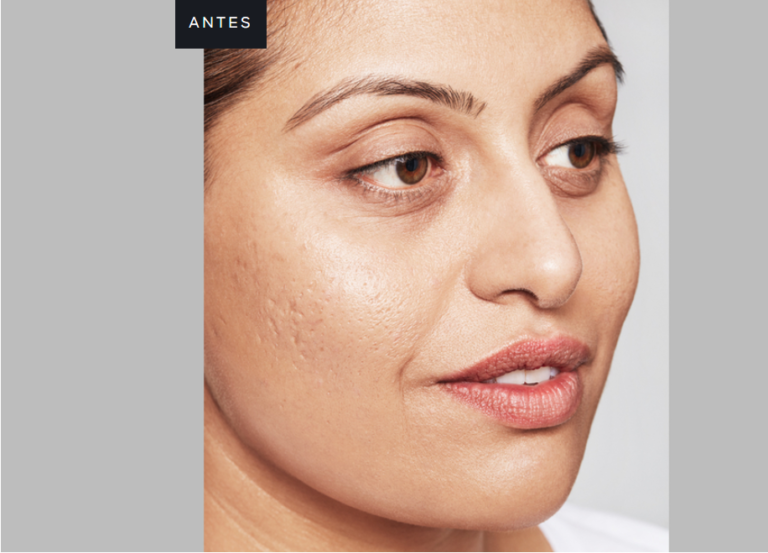 Skinbooster: O que é? Como funciona? Tudo o que você precisa saber!